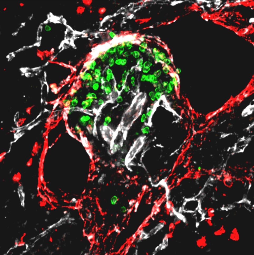 Neue Erkenntnisse zur Entstehung von Lymphknoten: VBIO