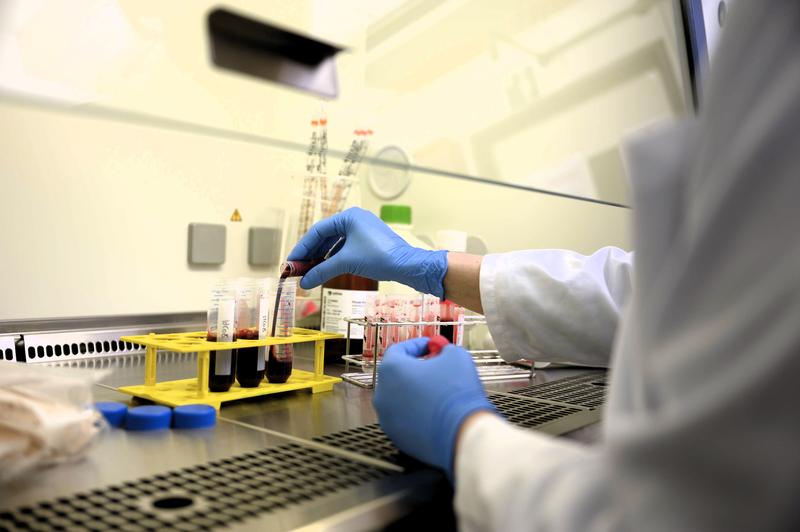 Autoimmunität: Immunzellen entgehen Therapie durch ruhenden Zustand: VBIO