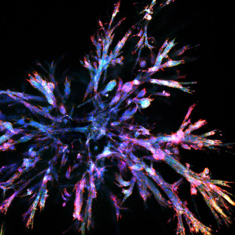 Organoide bilden erstmals die komplexe Zelllandschaft von ...