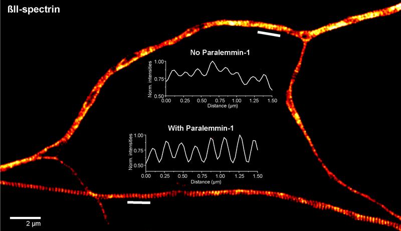 Neues regulierendes Protein des Zytoskeletts in Nervenzellen ...